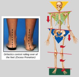 Tips on How to Correct Posture From the Feet Up - PostureInfoHub