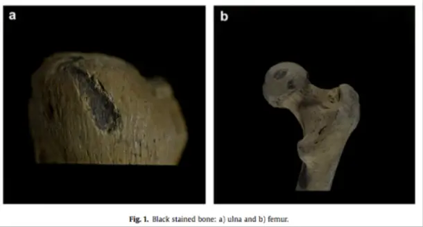 Why Are Bones White? - PostureInfoHub