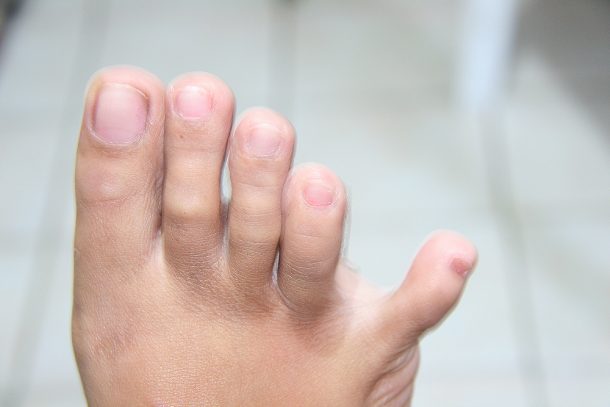 Why Do People Wiggle Their Toes? - PostureInfoHub