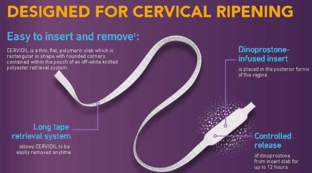 Can You Go to the Bathroom With Cervidil? - PostureInfoHub