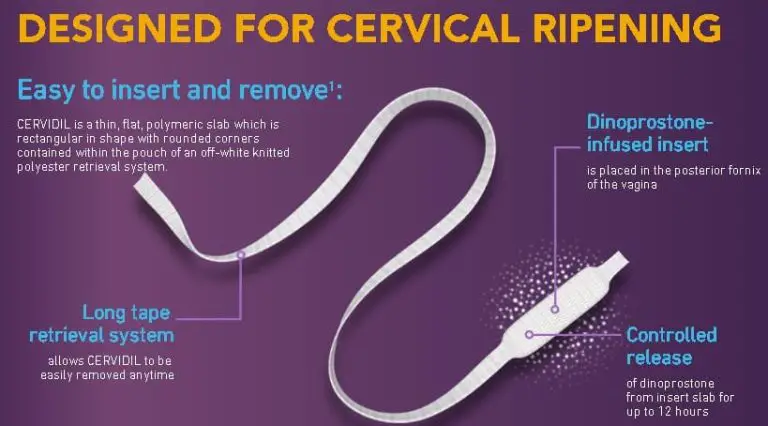 Can You Go to the Bathroom With Cervidil? - PostureInfoHub